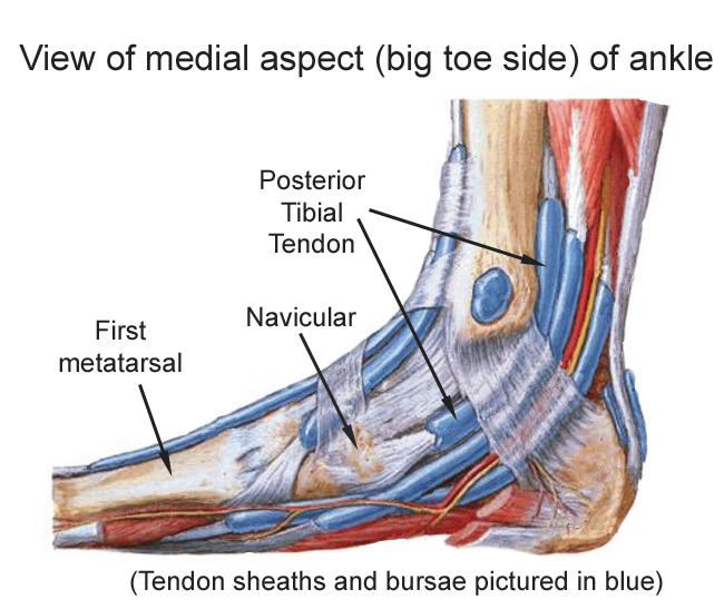 Posterior Tibial Tendonitis Drwolgin