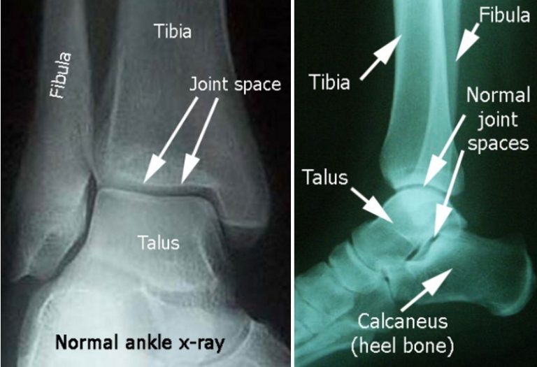 Anatomy: Foot/Ankle - Drwolgin
